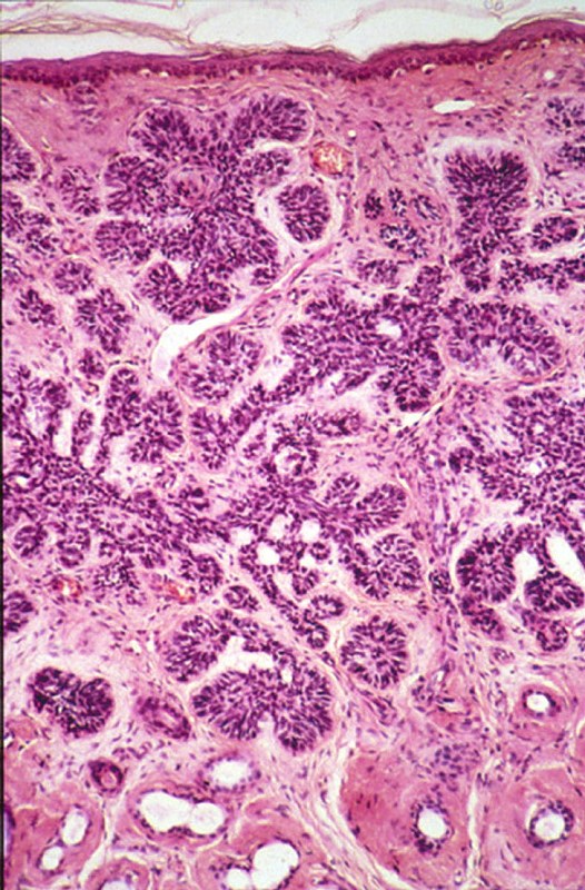 Duke Pathology - Bone, Joints, & Skin