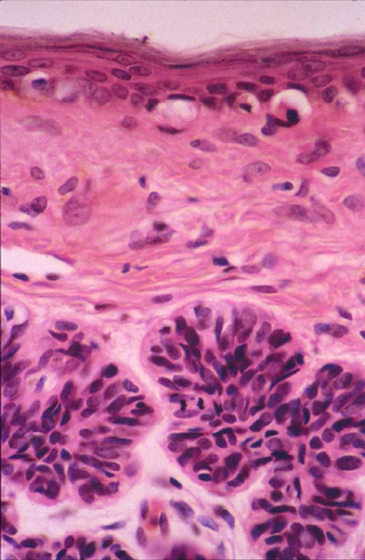 Duke Pathology - Bone, Joints, & Skin