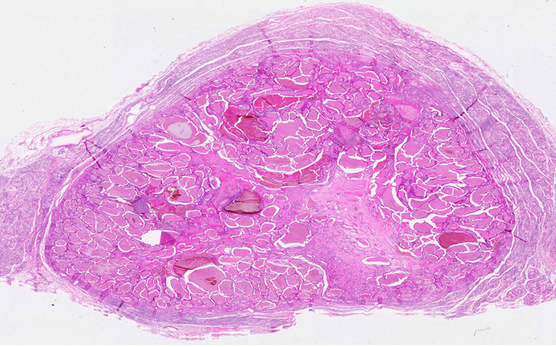 Duke Pathology - Endocrine, Hepatobiliary, & Pancreas