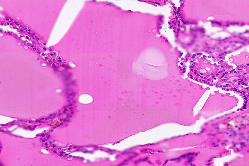 Duke Pathology - Endocrine & Male Genital